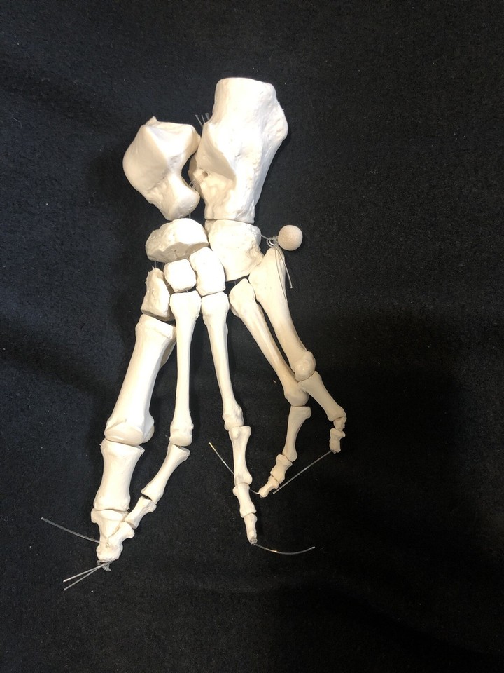3B Scientific Human Foot Skeleton Loosely Threaded on Nylon String ...