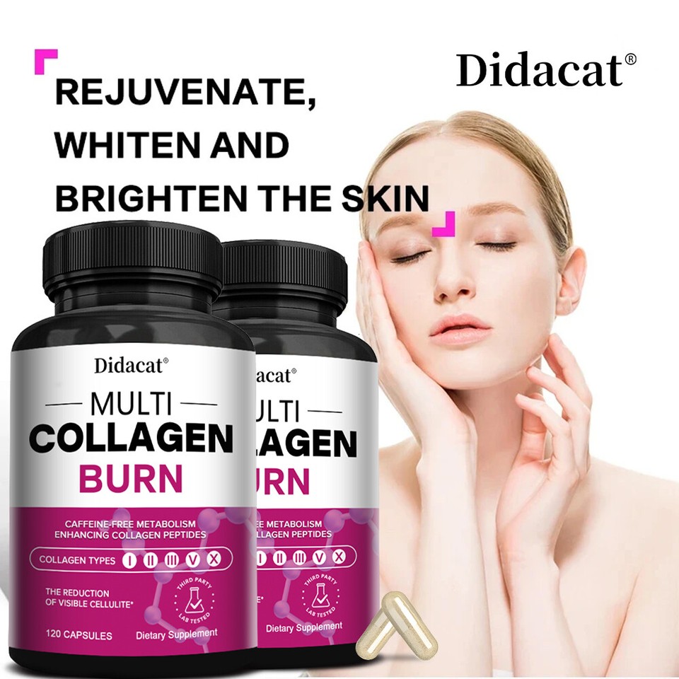 Multi Collagen Burn Capsules for Weight Loss - Hydrolyzed Collagen ...