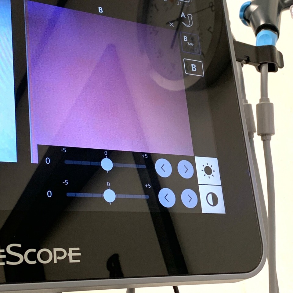 Glidescope Core 15, REF 0570-0404, Video Laryngoscope System w/ A/B ...