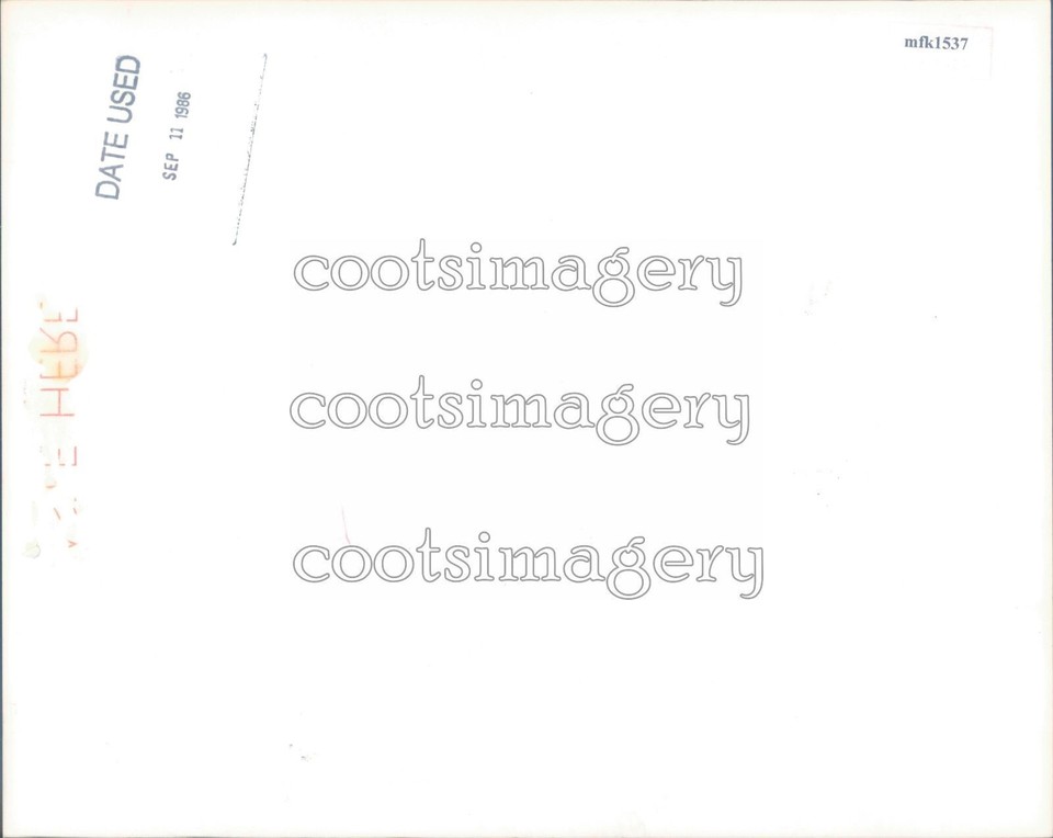 1986 Press Photo AIDS Victim Todd Shuttlesworth in Hospital Room 1980s ...