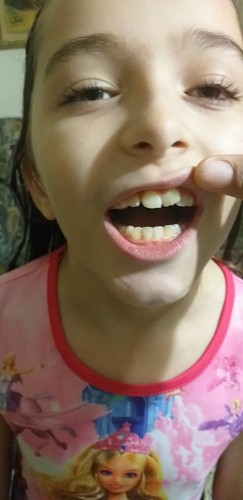 Dental Teeth Trainer Practical Support Orthodontic T4k Aligner Kid ...