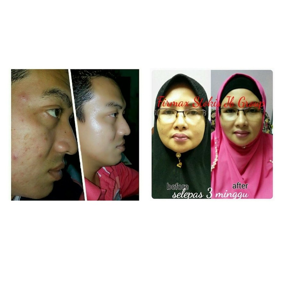 Firmax3 Firming & Lifting Cream Of Nanotechnology Hormone Therapy for ...