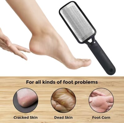 Smooth and Soft Feet in Seconds - Foot Rasp File and Callus Remover ...