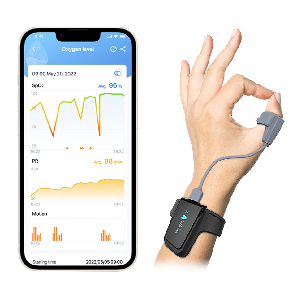 Wellue Checkme O2 Max Pulse Oximeter O2 Sensor Ring Tracking SpO2 Heart ...