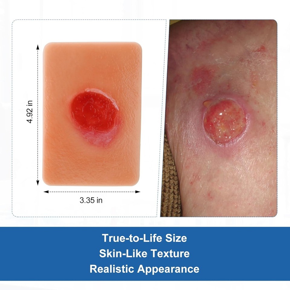 Decubitus Ulcer Wound Care Model Bedsores Model Pressure Injury Model ...