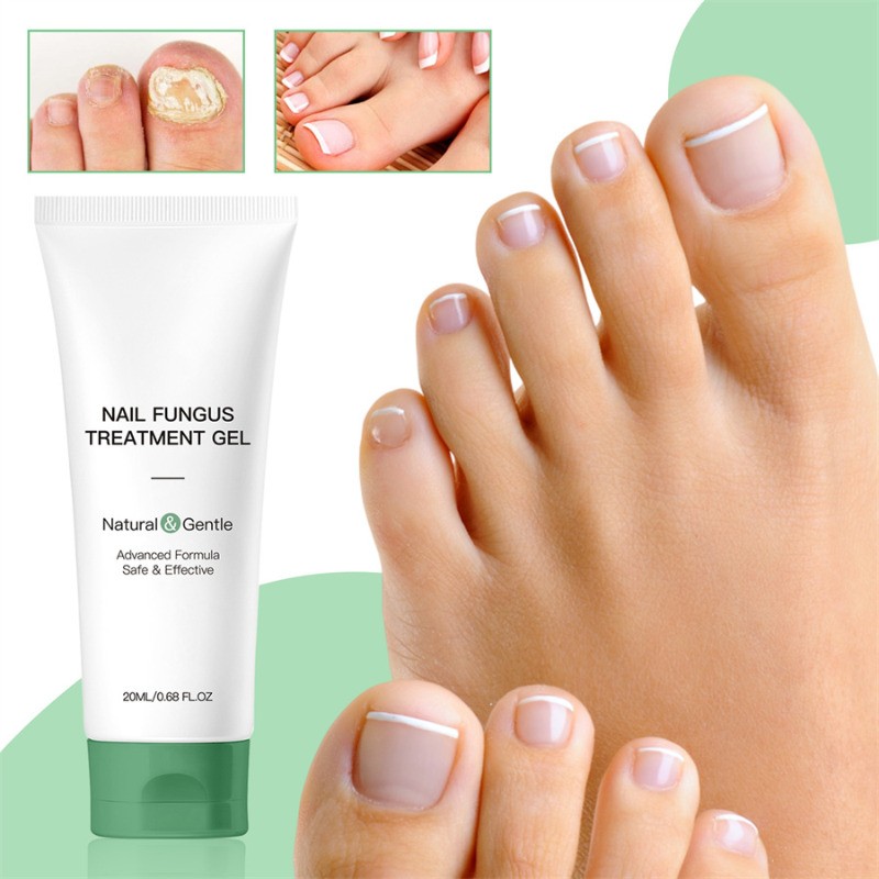 1~3PCS Nutraboost Nail Fungus Treatment Gel, Nail Fungus, Fungus Cream ...