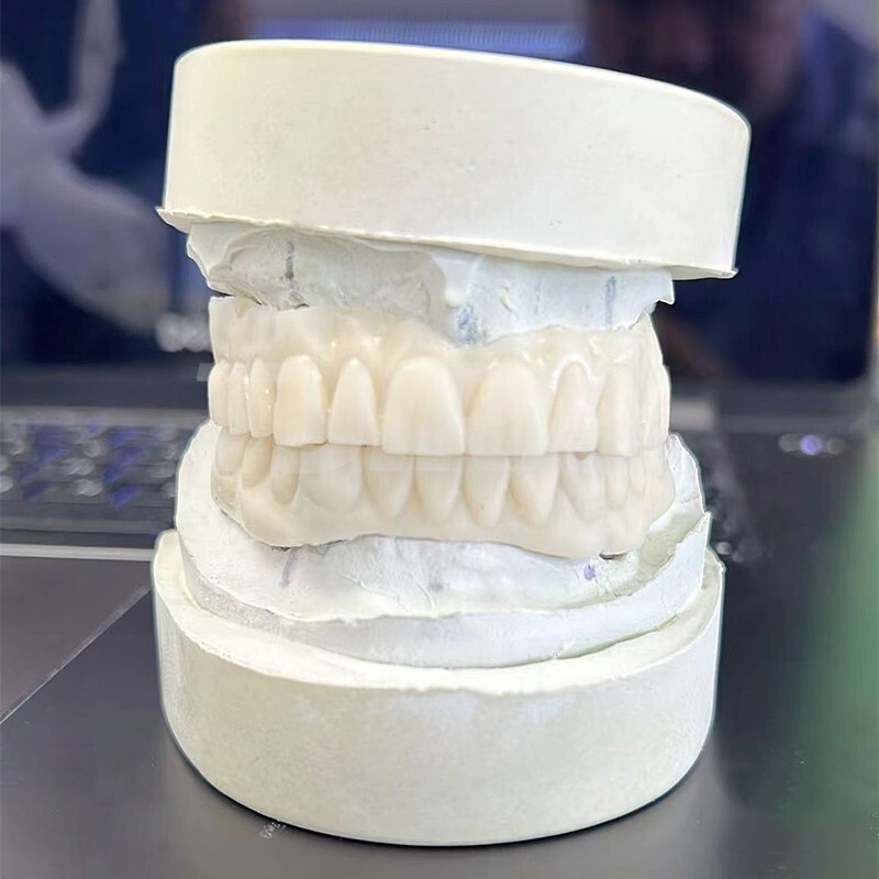 LCD DLP Dental 3D Printer Temporary Teeth Resin Crown Bridge 3D Resin ...