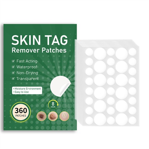 360 PCs/box Warts Remover Patch Safe Painless Skin Tags Treatment Wart ...