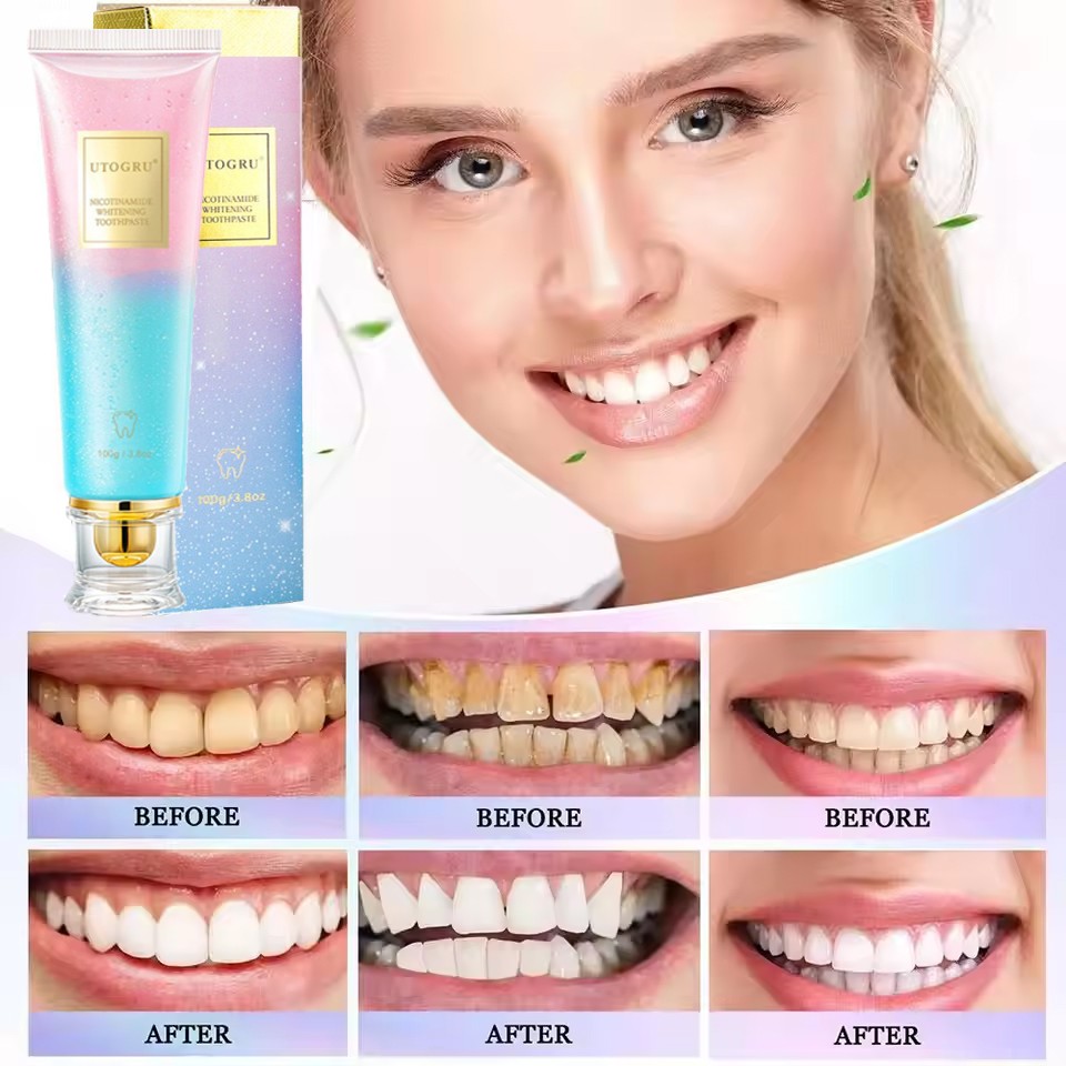 Niacinamide Whitening Toothpaste,Probiotic Whitening Toothpaste, Teeth ...