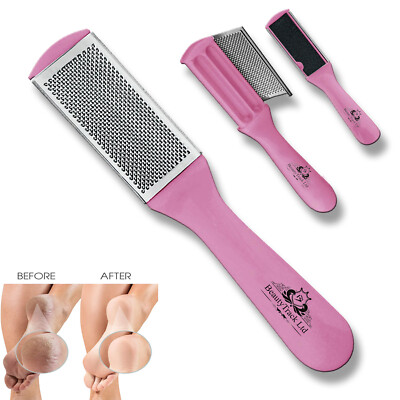 Foot Rasp File Callus Remover Hard Dead Rough Skin Scrubber Dual Sided ...