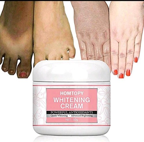 Homtopy Skin Whitening Cream 50g, Repair Joint, Elbow, Knee, Fading ...