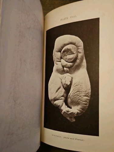 Rare early Medical Monsters & Freaks / Human Oddities Cases Illustrated ...