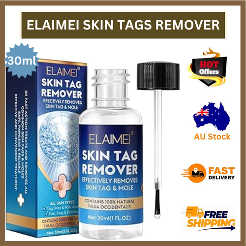 Fast Skin Tag Remover Instant Treatment Safe Wart Acne Removal Face ...