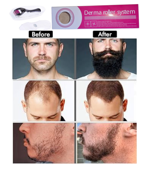 Beard Derma Roller For Hair Loss Beard Growth Titanium Derma Roller ...