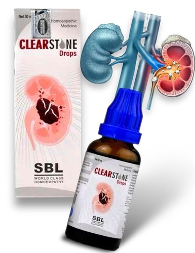 SBL Homeopathic Remedy Clearstone Drop 30ml (35% de réduction sur 3X ...