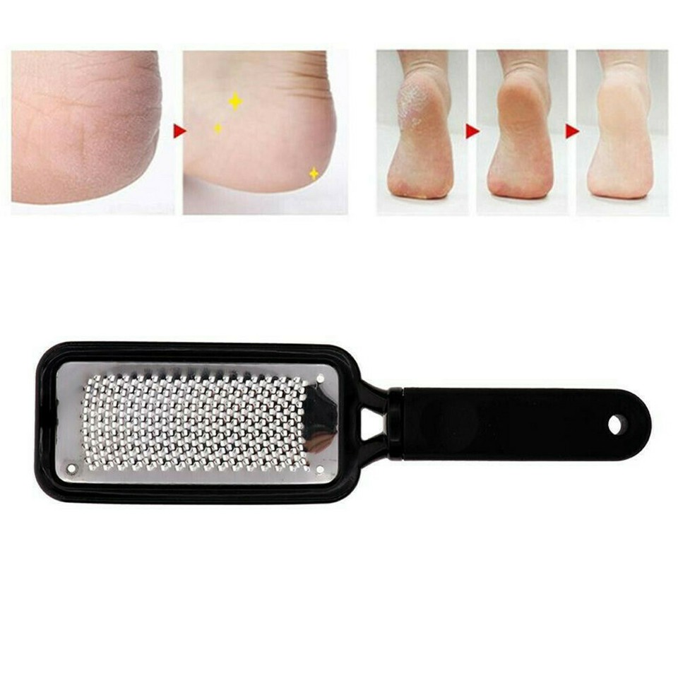 Foot File Hard Dead Skin Callus Remover Rasp Scraper Dead Skin Scrubber ...