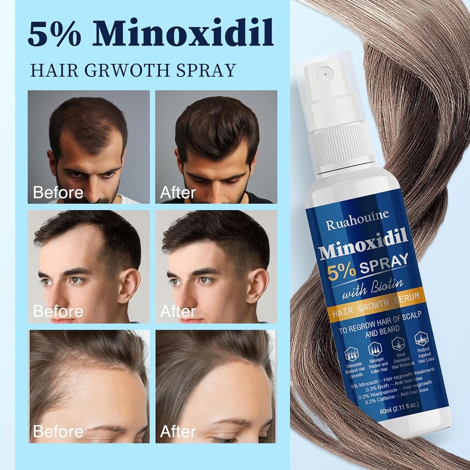 5% Minoxidil Hair Growth Spray Serum, Hair Regrowth Treatment for Men ...