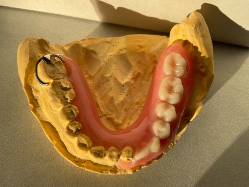 Vintage Lower Partial (False Teeth) Acrylic on model display ~ Dental ...