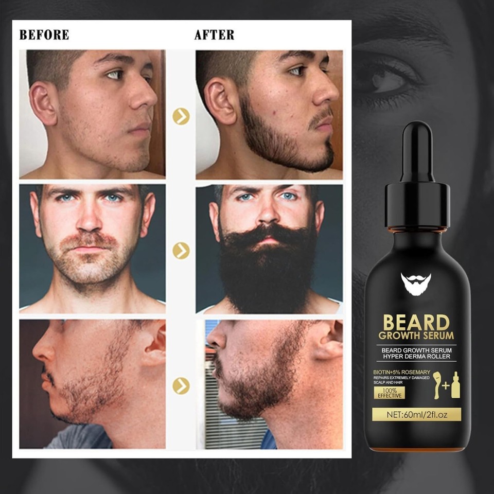 Nourishing Beard Growth Oil & Derma Roller Combo - Ideal for Men, 60ml ...
