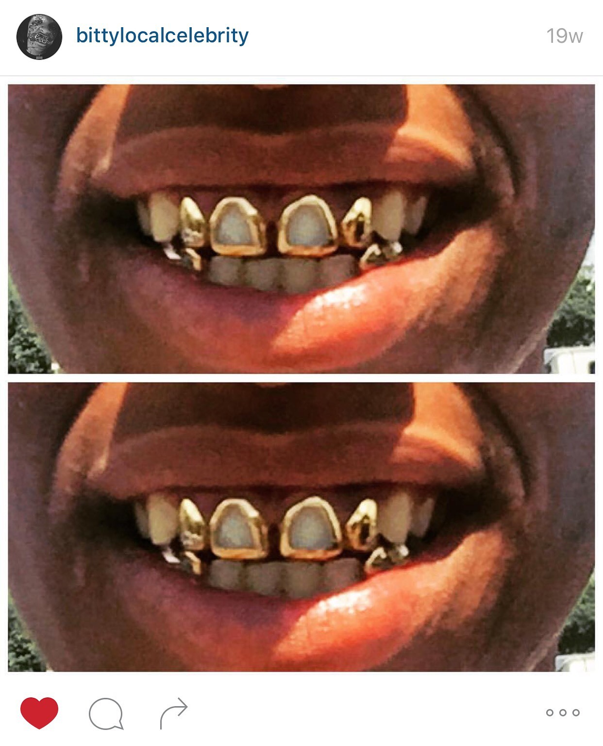 14k Solid Gold Grills With Deep Cut/Permanent Looking 6 Top Custom Fit ...