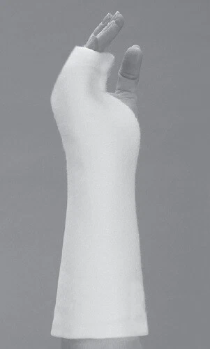 Ulnar Gutter Cast