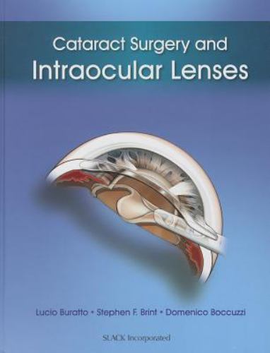 Cataract Surgery and Intraocular Lenses by Domenico Boccuzzi, Lucio ...