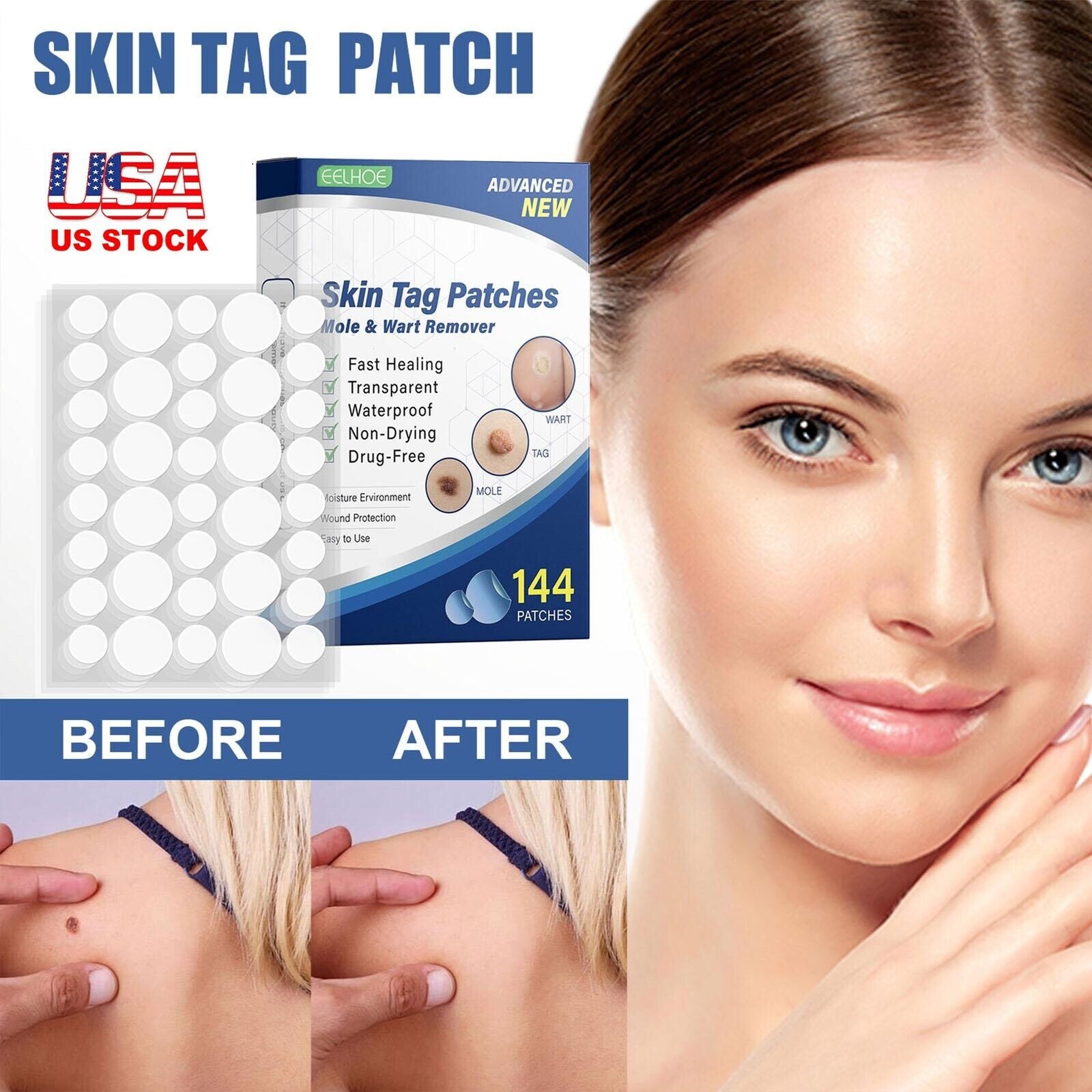 288pcs Skin Tag Remover Patches Quick Effective Mole Wart Removal Pad ...