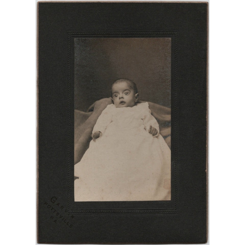Bug-Eyed Baby Cabinet Card Photo Large Eyes Child Kid Pottsville PA ...