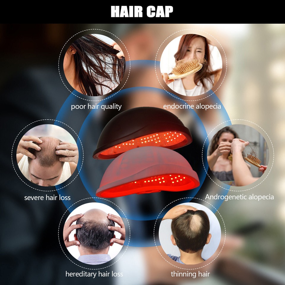 312 LED Red Light Hair Growth Cap Hair Loss Treatment Device Regrowth ...