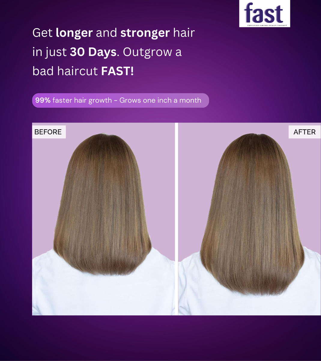 Bad Haircut Need Hair To Grow Fast How To Grow Out An Undercut (& What