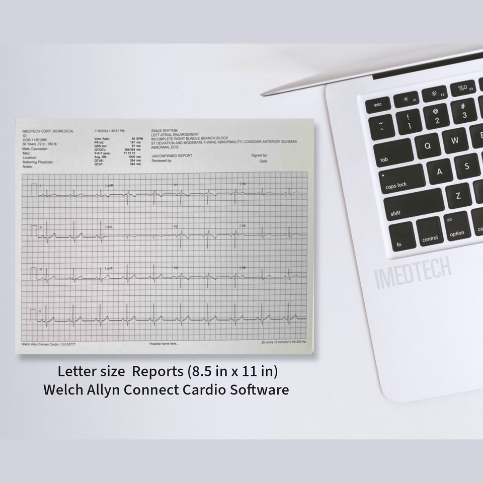 Welch Allyn Connex Cardio Cardiology Suite PC base digital ECG | eBay