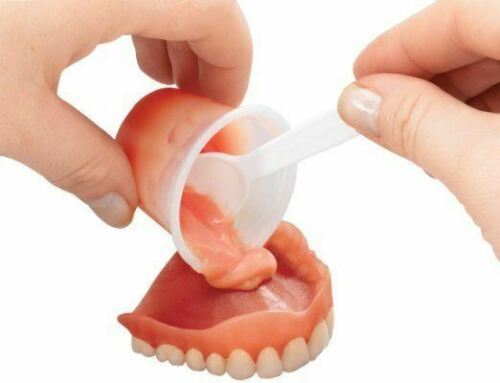 DSI Dental Soft Reline Kit DIY Denture Tissue Conditioner Cushioning ...