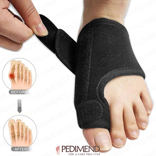 Pedimend™ Adjustable Bunion Splint Orthopedic Big Toe Straightenr Turf ...