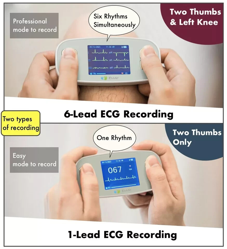 EMAY 6Leads Portable ECG Monitor Record ECG and Heart Rate in 6 ...