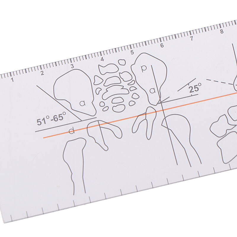 Multi-Ruler Goniometer Angle Medical Ruler Joint Orthopedics Tool ...