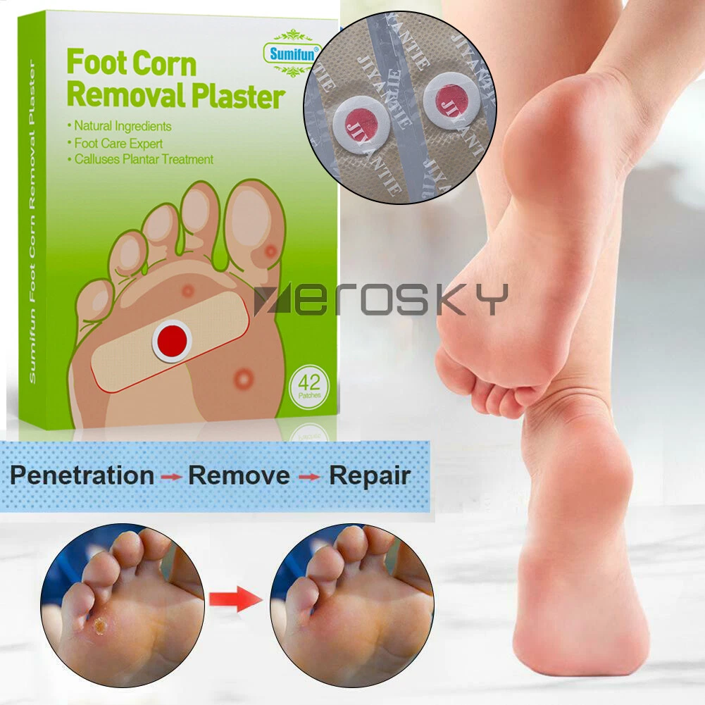 Best Foot Corn Removal