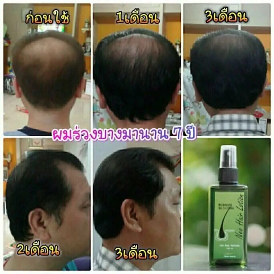 NEO+Hair+Lotion+Root+Treatment+Nutrients+Spray+-+120+ml for sale online ...