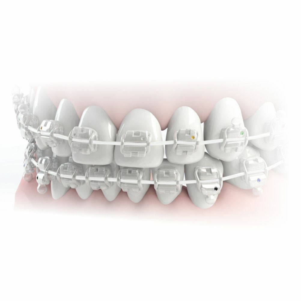 NiTi Dental White Orthodontic Archwire Superelastic Aesthetic Round 5 ...