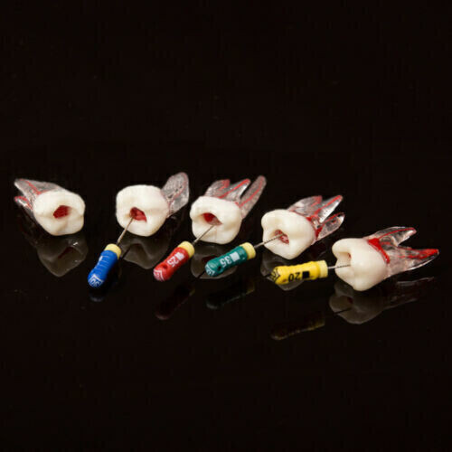 20Pc Dental Tooth Endo Root Canal Study Model RCT Practice Block Pulp ...