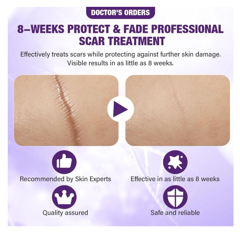 Scar Cream,Scar Gel,Scar Cream For Surgical Scars,Scar Removal Cream ...