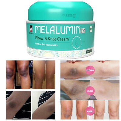 Melalumin Elbow & Knee Cream 50gm helps exfoliate and lighten ...