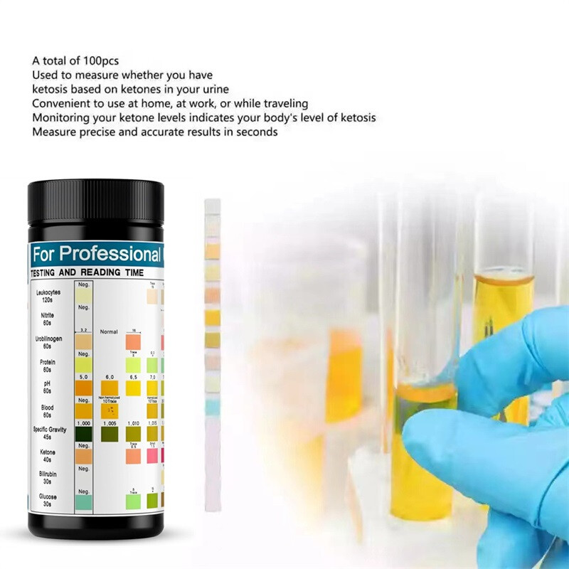 100 Strips Urine Test Strip 10 Parameters Urinalysis Dip-Stick PH Test ...