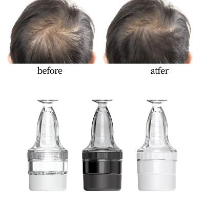 Scalp Oil Comb, Scalp Serum , Hair Oil , Applying Hair Oil, Hairspray ...