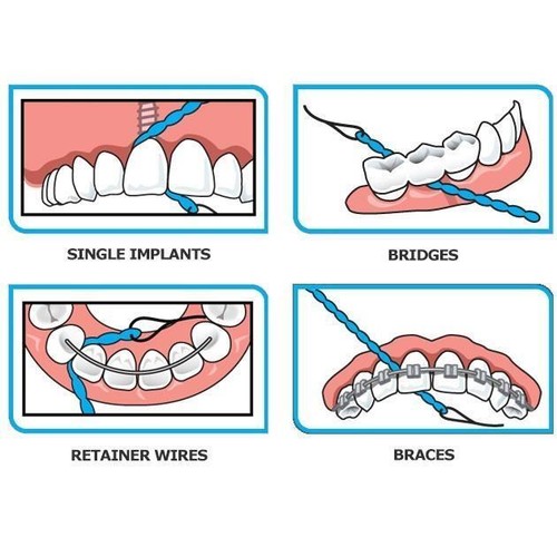 Idontix X-Floss Lite Thin Dental Floss - 30 Strands In Pack | eBay UK