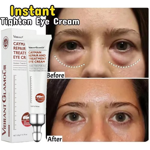 Magic Eye Cream 28 Seconds to Remove Eye Bags / Dark Circles / Eye ...