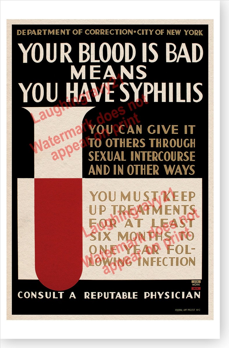 syphilis
