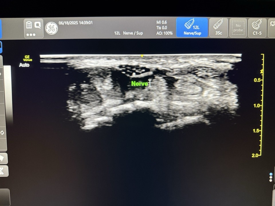 GE Venue R2 Ultrasound System LCD Flat Touchscreen Monitor Choice Of ...