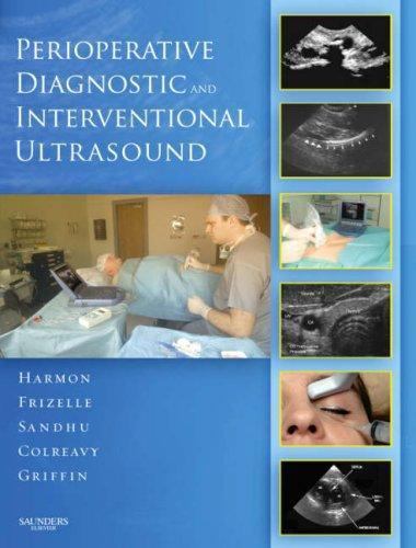 Perioperative Diagnostic and Interventional Ultrasound by Frances B ...