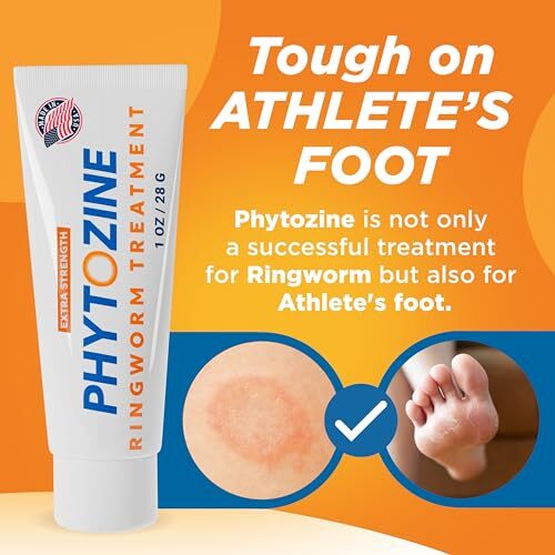 - Extra Strength Antifungal Ringworm Treatment Cream for Humans ...