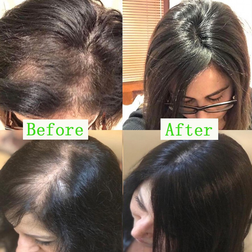 Women Topper With 2cm PU In Virgin European Human Hair Silk Top Toupee ...